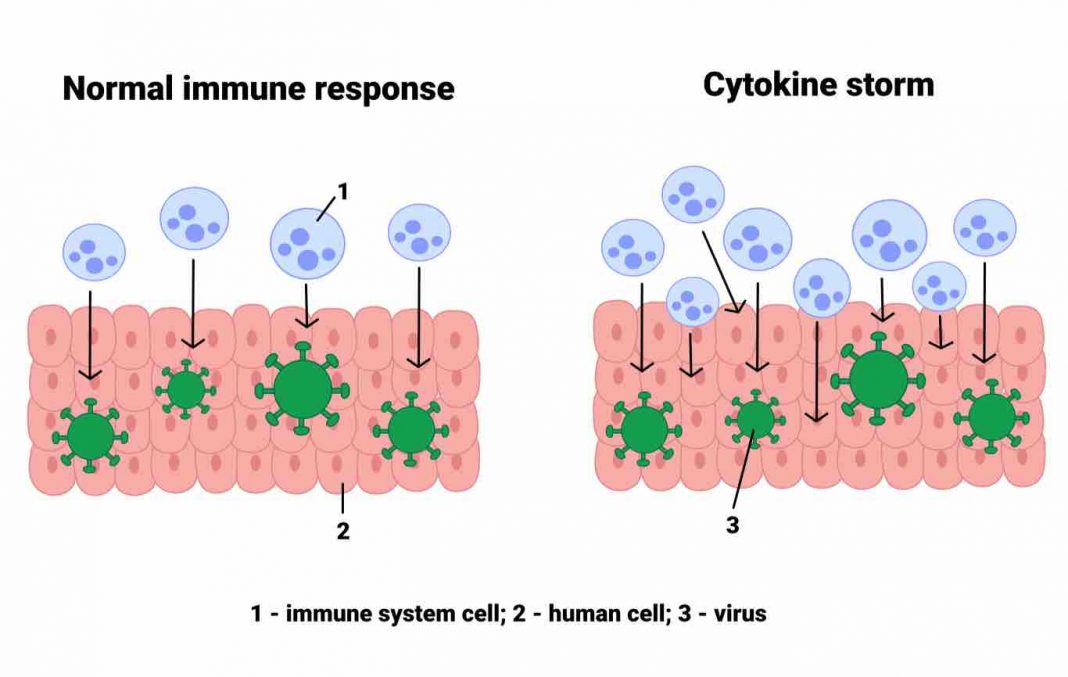 15 Symptoms of Cytokine Storm in Covid-19 Patients | USA Health Articles