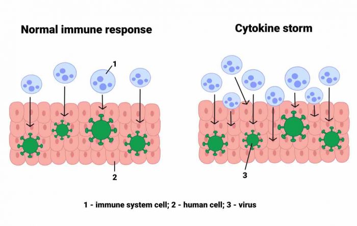 15 Symptoms of Cytokine Storm in Covid-19 Patients | USA Health Articles